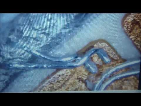 Destroyed VFD teardown and failure analysis